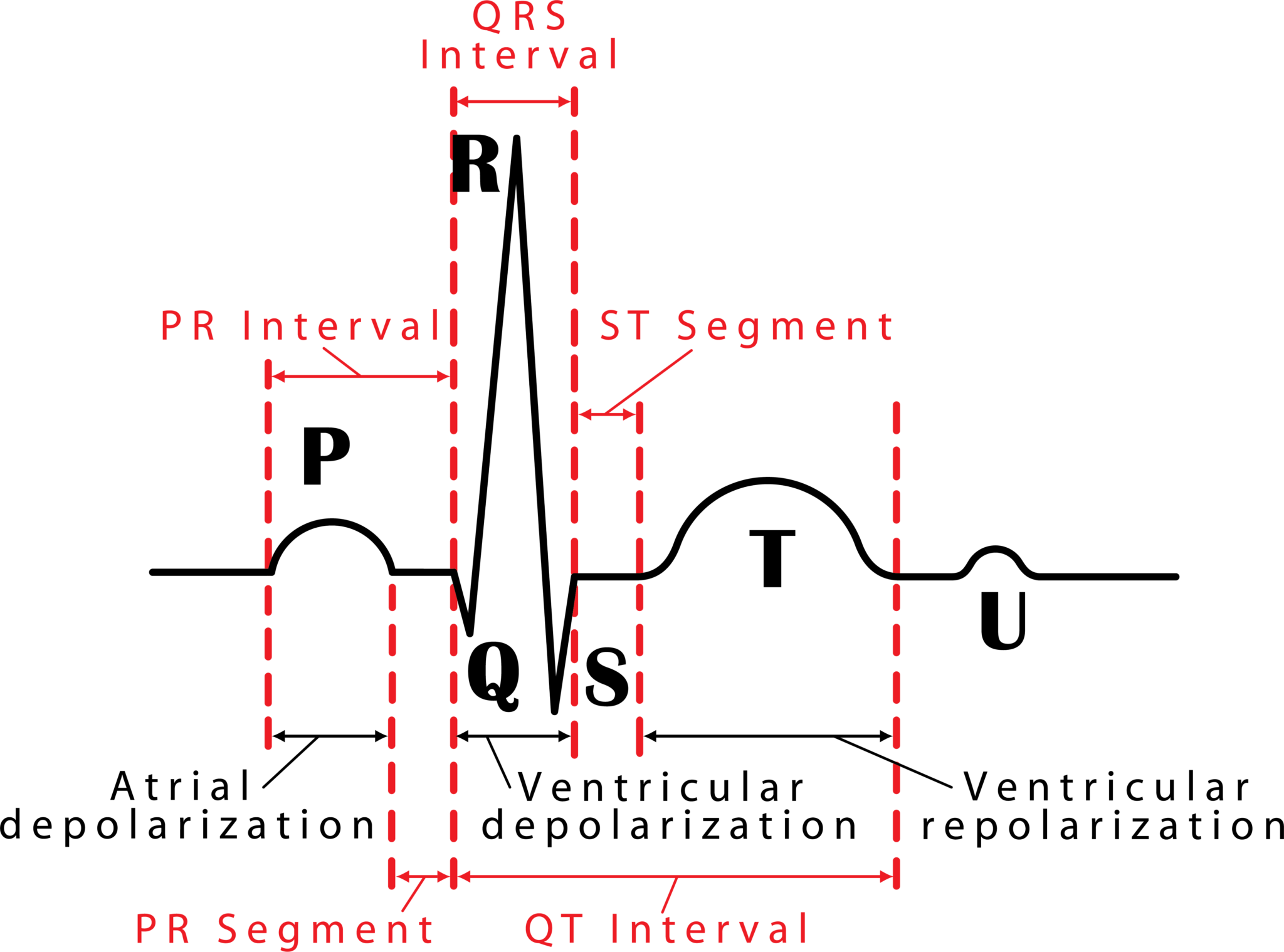 048 How to Read an Electrocardiogram (ECG/EKG) | Interactive Biology ...